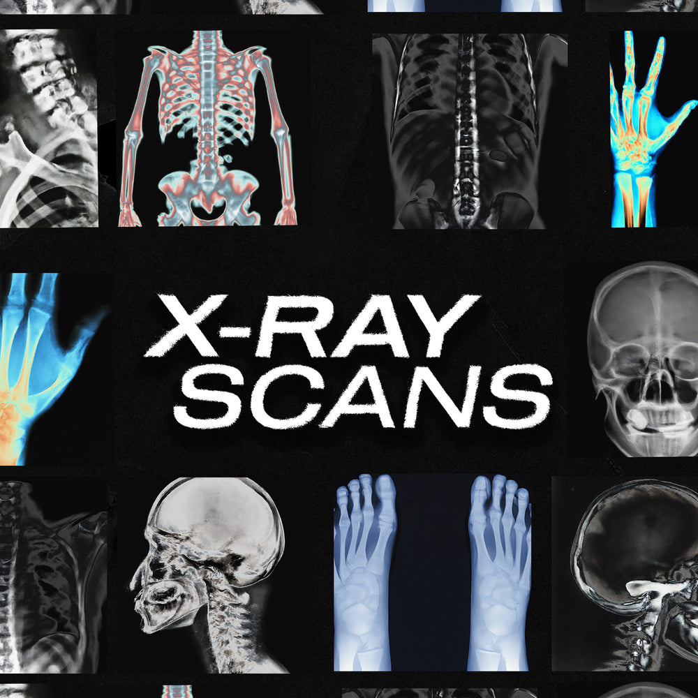 X-RAY SCANS – by secret-cache